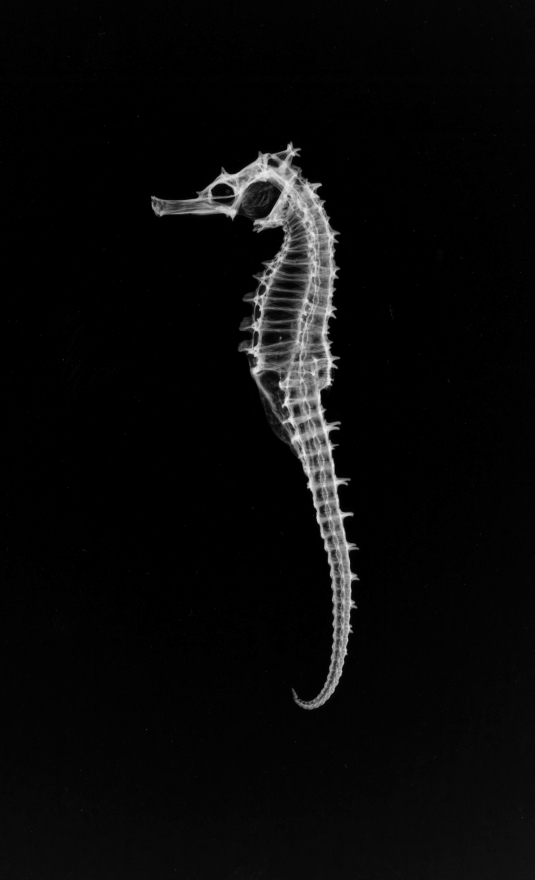 X-Ray Photography – SheWalksSoftly