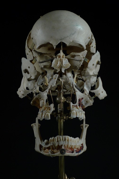 Ryan Matthew: Exploded Skulls – SheWalksSoftly