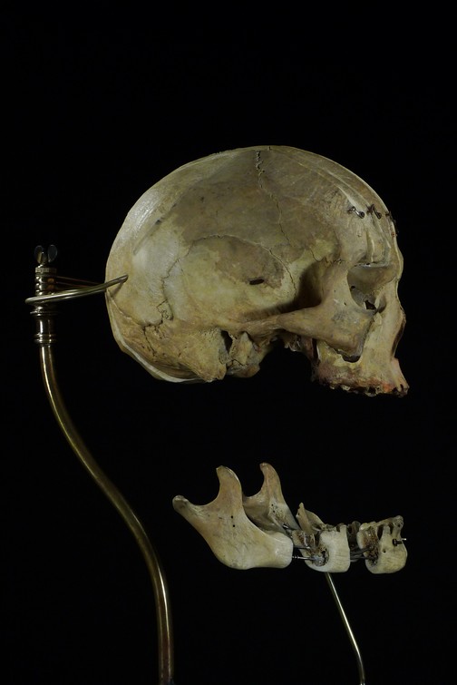 Ryan Matthew: Sliced Skulls – SheWalksSoftly