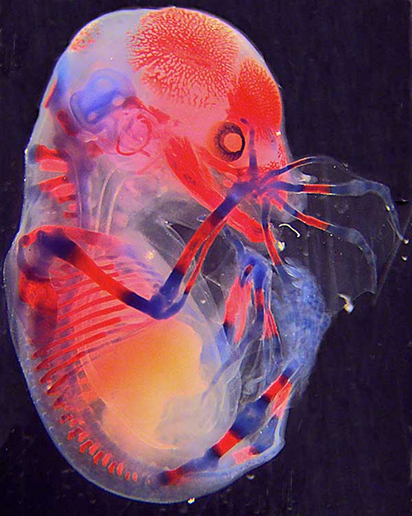 Image Odyssey: Bat Embryos – SheWalksSoftly